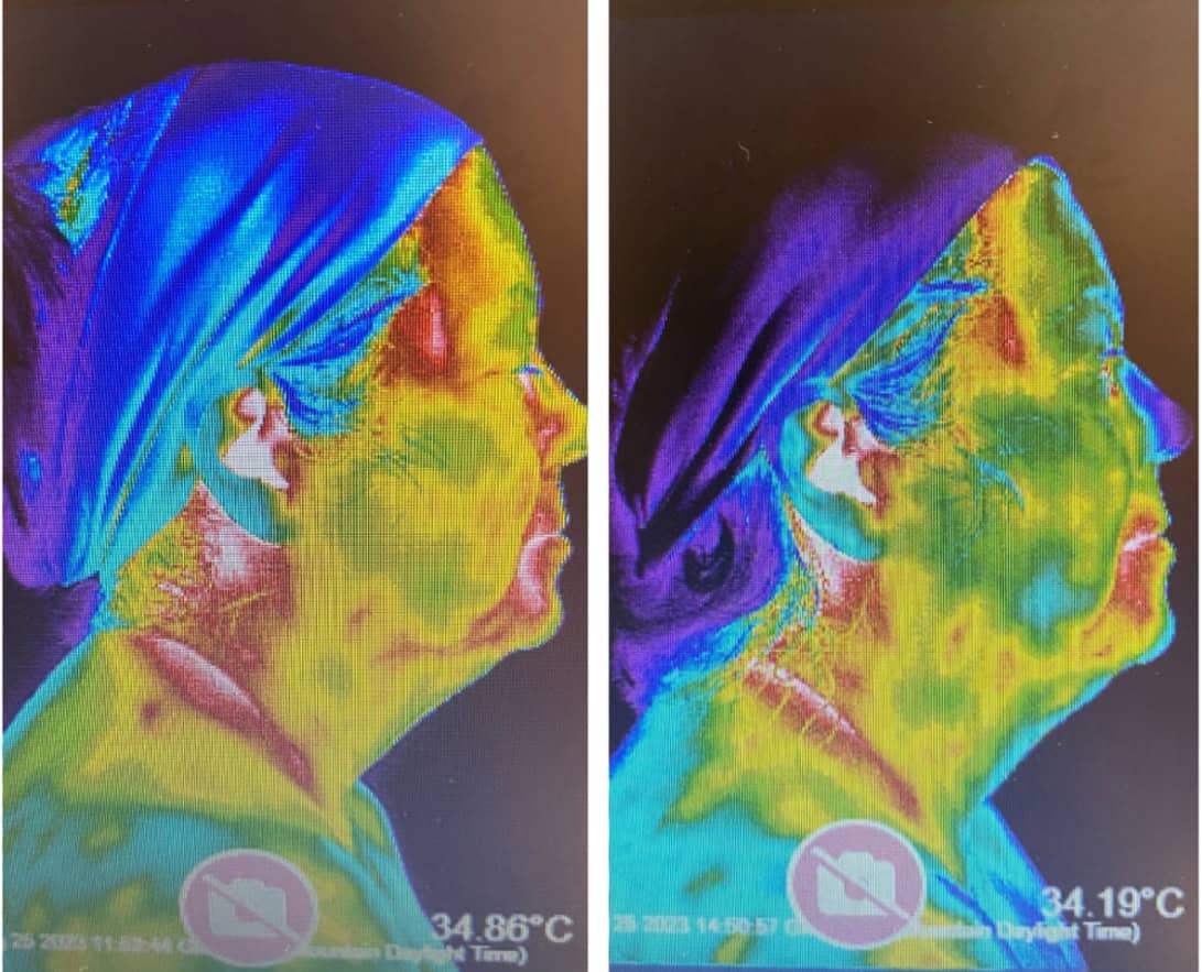 Thermography Scans for Insight Into Your Health